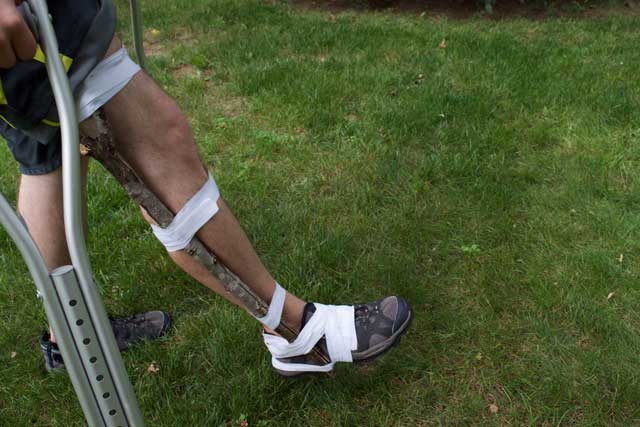 Creating an Emergency Splint for Use in a Disaster Scenario - The ...